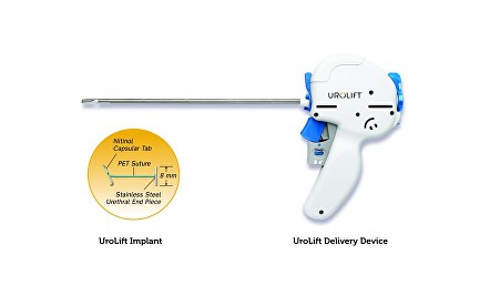 UroLift | Minimally Invasive Treatment for BPH | The Urology Partnership
