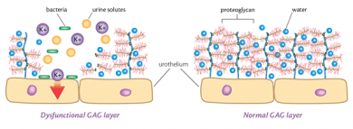 Intravesical Treatment for Recurrent UTIs | The Urology Partnership