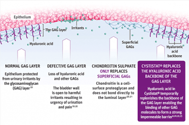 Intravesical Treatment for Recurrent UTIs | The Urology Partnership