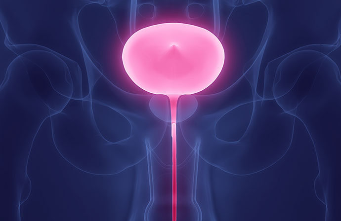 Suprapubic Catheter Centre | The Urology Partnership
